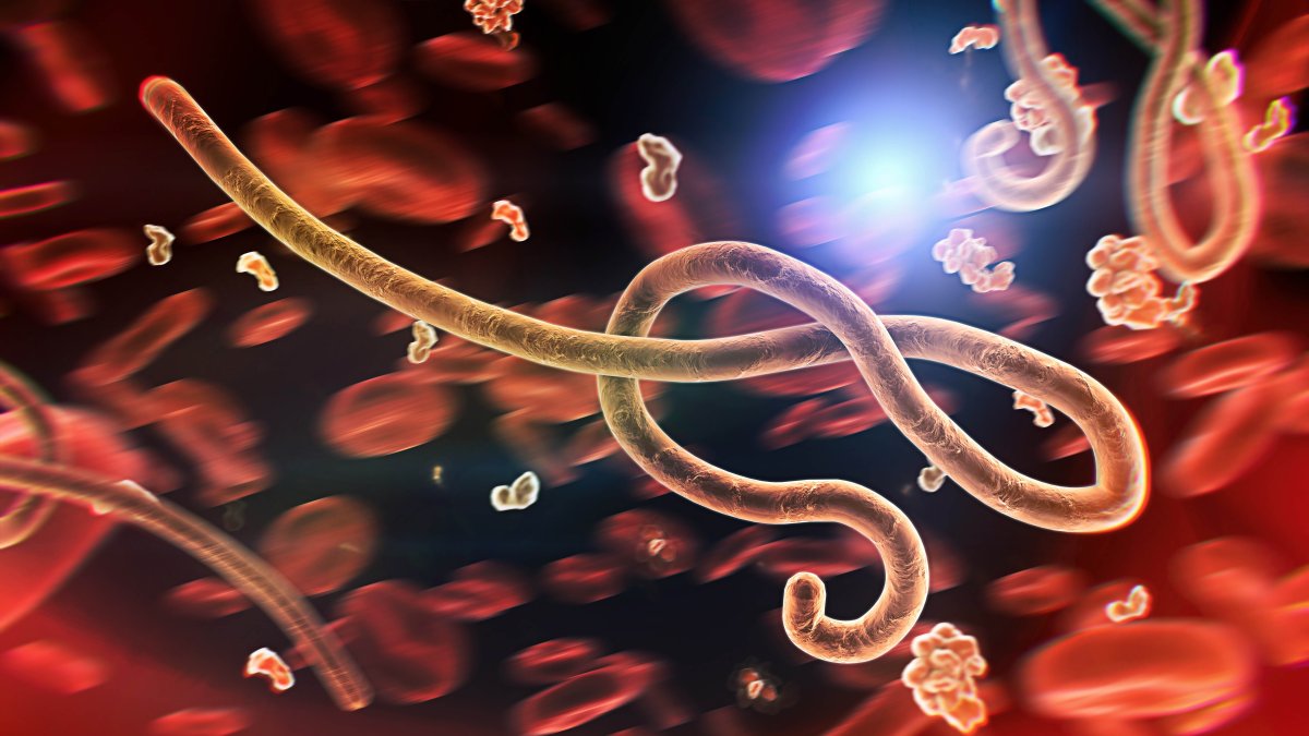 Qué es el ébola y cuáles son los síntomas del peligroso virus ... Qué es el ébola y cuáles son los síntomas del peligroso virus ...