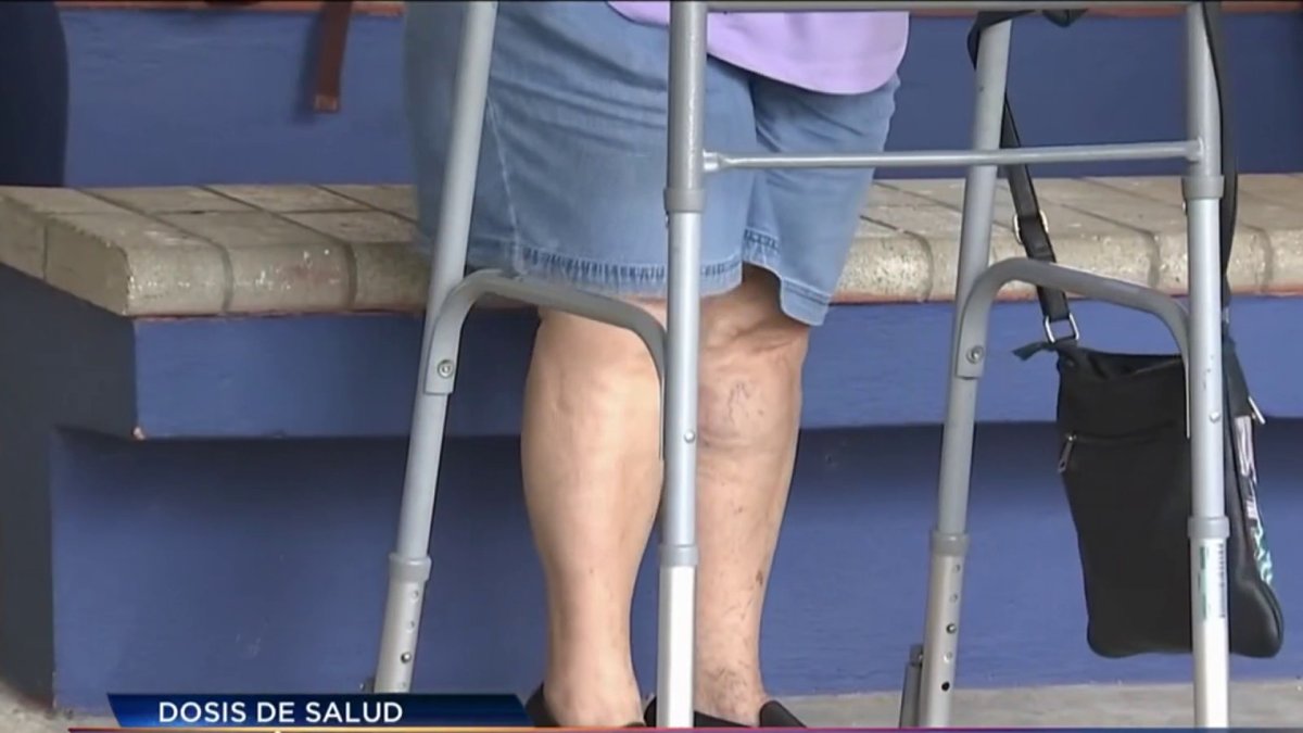 El sobrepeso y cómo afecta la salud de nuestras piernas – Telemundo ...