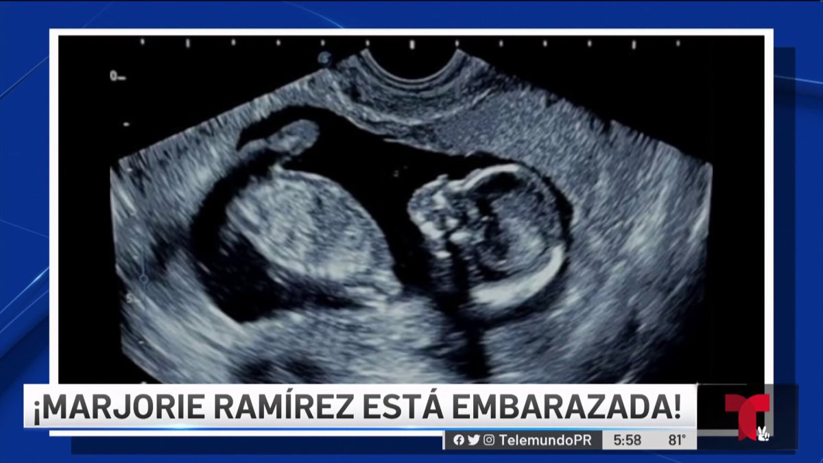 ¡Gran alegría! Marjorie Ramírez está embarazada – Telemundo Puerto Rico