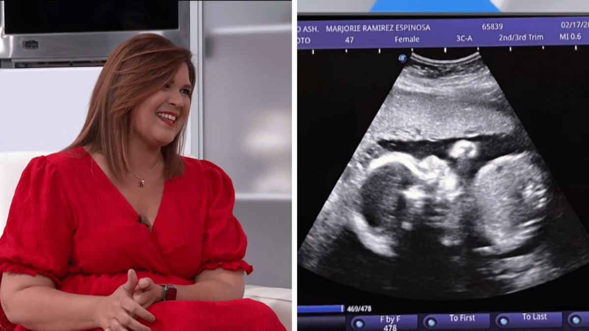 Marjorie Ramírez revela sonograma de su "baby boy" – Telemundo Puerto Rico