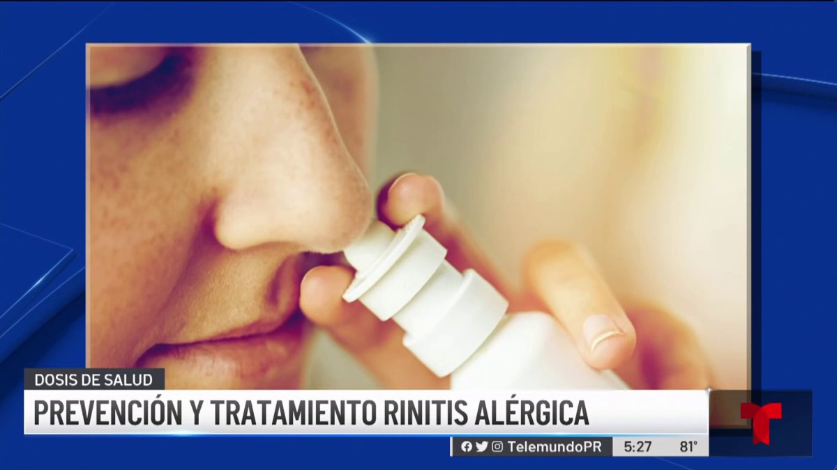 Cómo Prevenir Y Tratar La Rinitis Alérgica Telemundo Puerto Rico