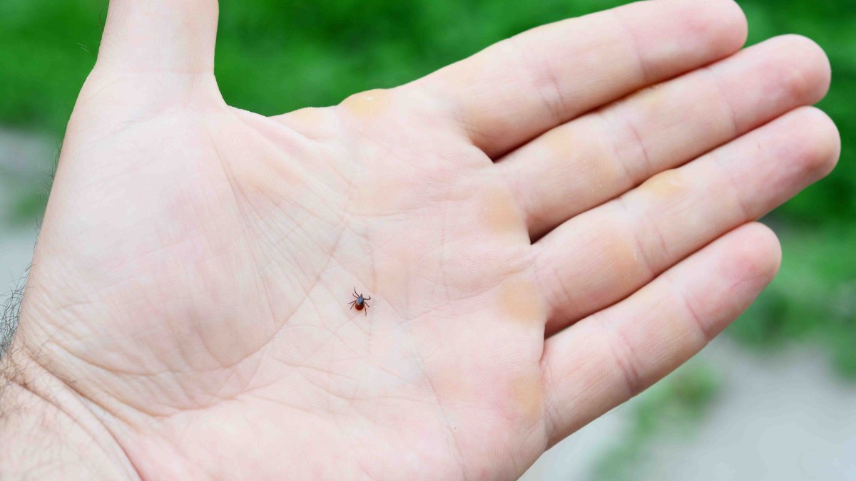 Alergias a la carne por picaduras de garrapatas – Telemundo Puerto Rico