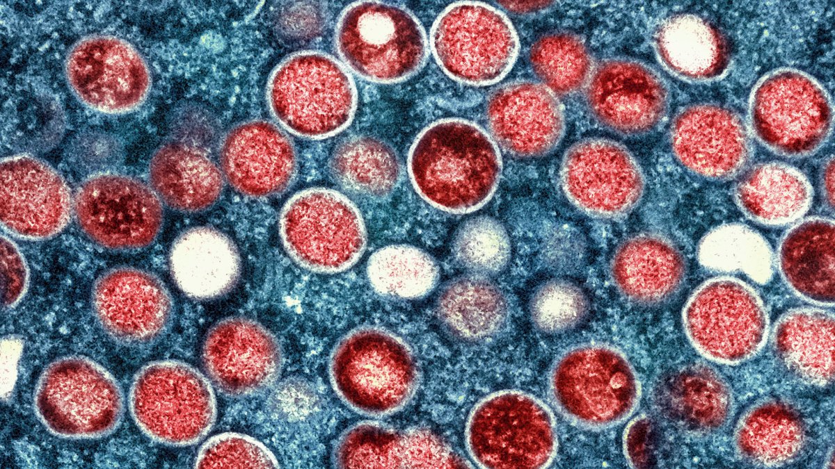 OMS declara brote del virus mpox como emergencia de salud global ...