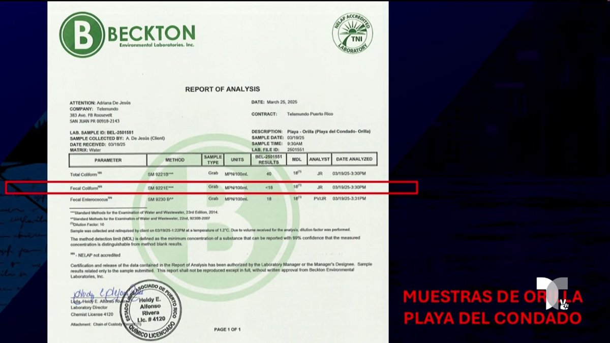 Estudio de Rayos X confirma presencia de coliforme en playa del Condado ...